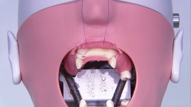 Имплантология (16 часть, промывание места имплантации)