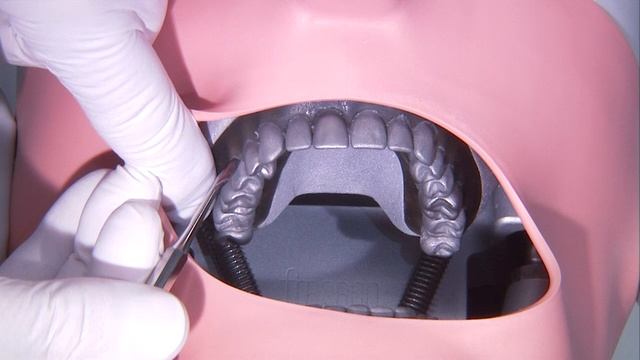 Удаление зуба (1 часть, синдесмотомия, зуб 15)