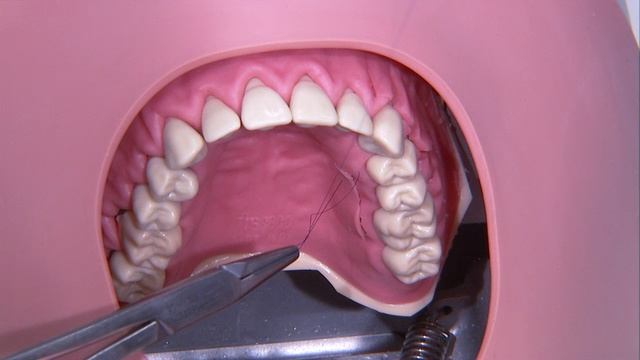 Пластическая хирургия пародонта (11 часть, закрытие раны, небной)