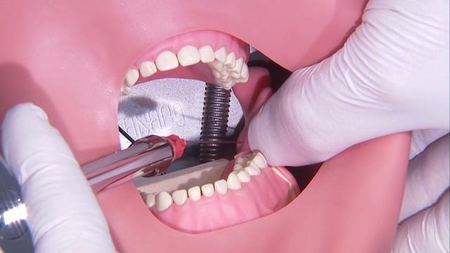 Местная анестезия (6 часть, проводниковая анестезия в области нижней челюсти у детей, левая сторона)