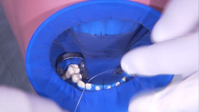 Наложение коффердама (2 часть)