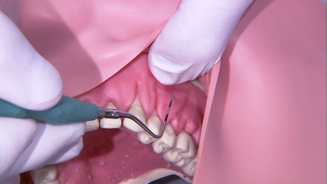 Пластическая хирургия пародонта(3 часть, диагностика дефектов с расхождением краев раны/вид разреза)