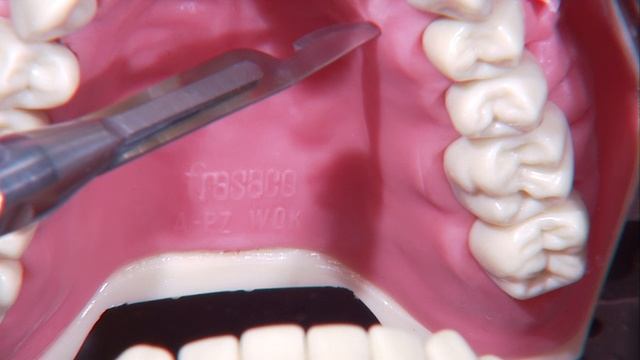 Пластическая хирургия пародонта (8 часть, разрез небный)