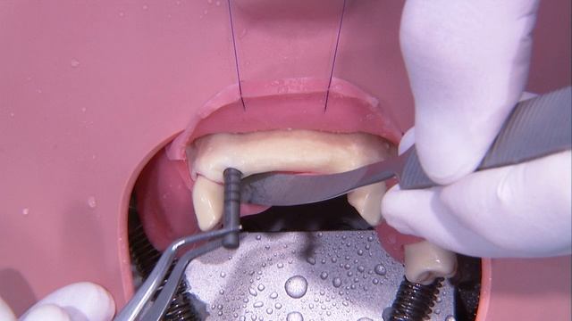 Имплантология (13 часть, измерение глубины)