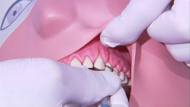 Пластическая хирургия пародонта (2 часть, масштабирование)