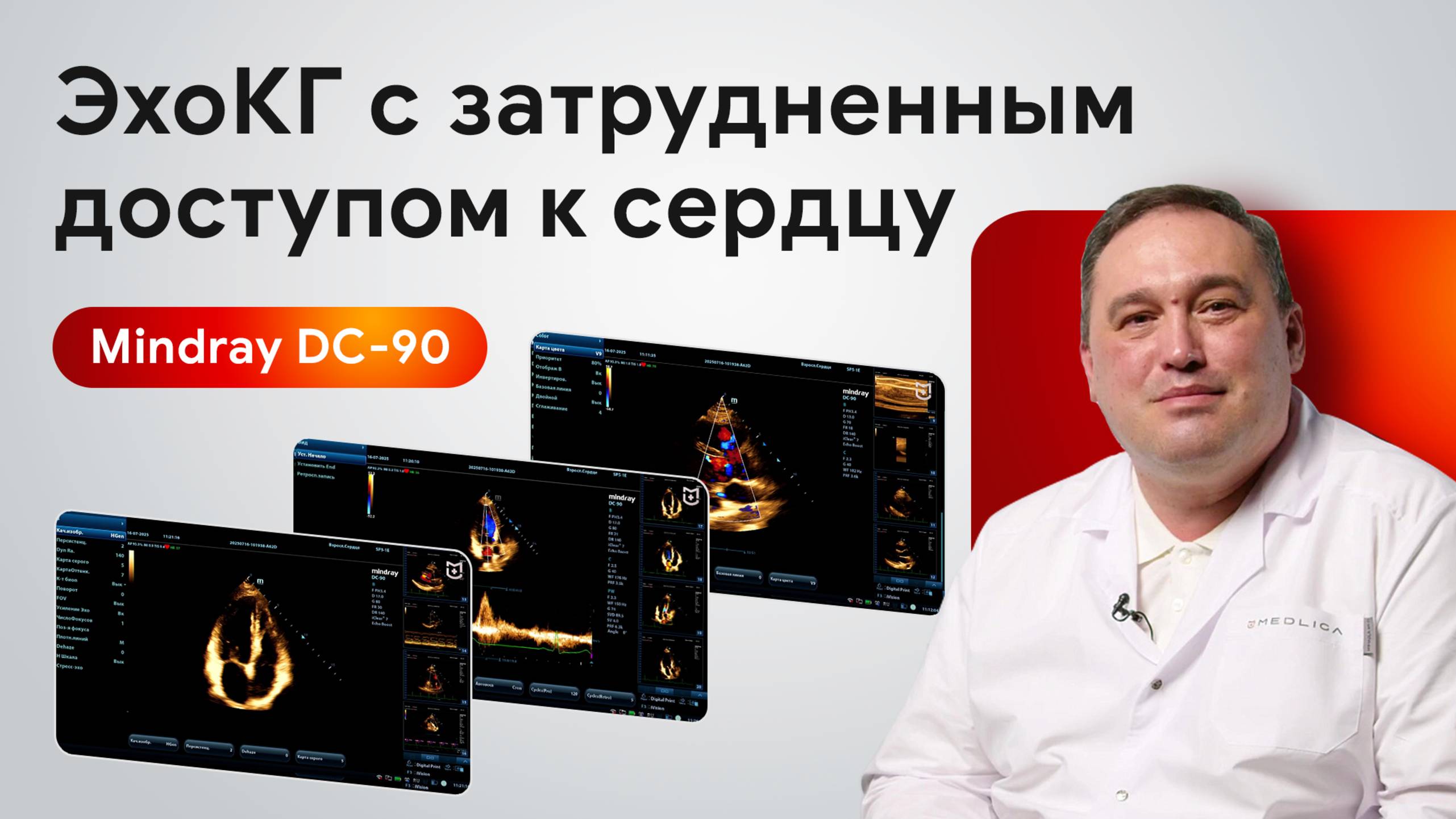 Как грудные импланты влияют на ЭхоКГ? Мастер-класс на Mindray DC-90