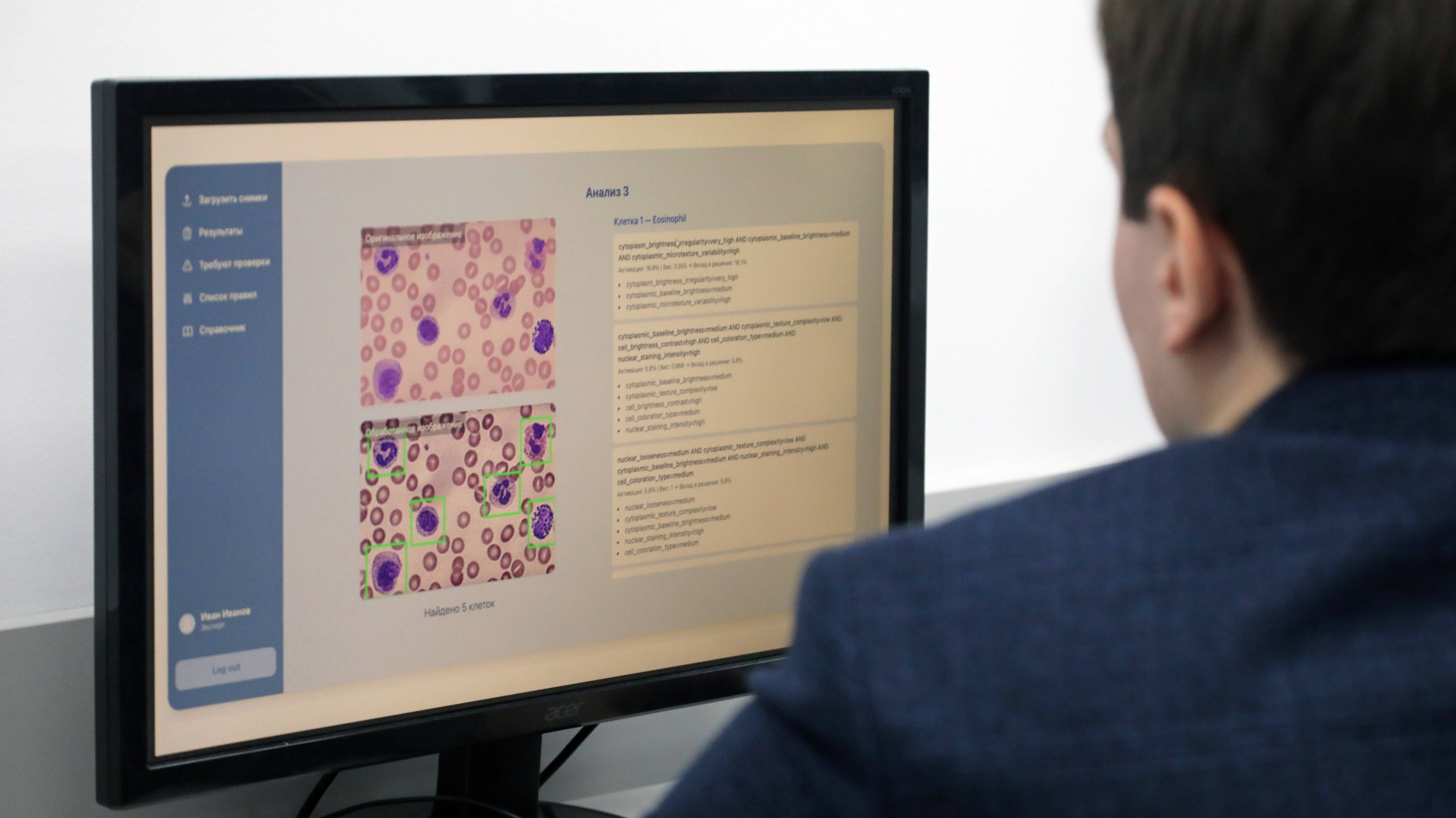 Учёные НИУ «БелГУ» создали систему, распознающую типы лейкоцитов на микроскопических снимках