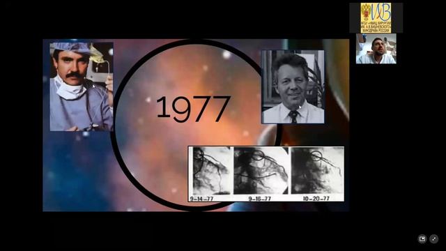 19 ЭхоКГ Часть 2 И Эндоваскулярная кардиохирургия