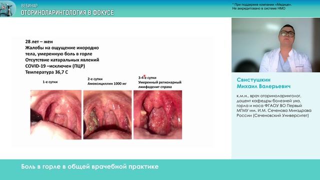 14.10.25 Вебинар Оториноларингология в фокусе