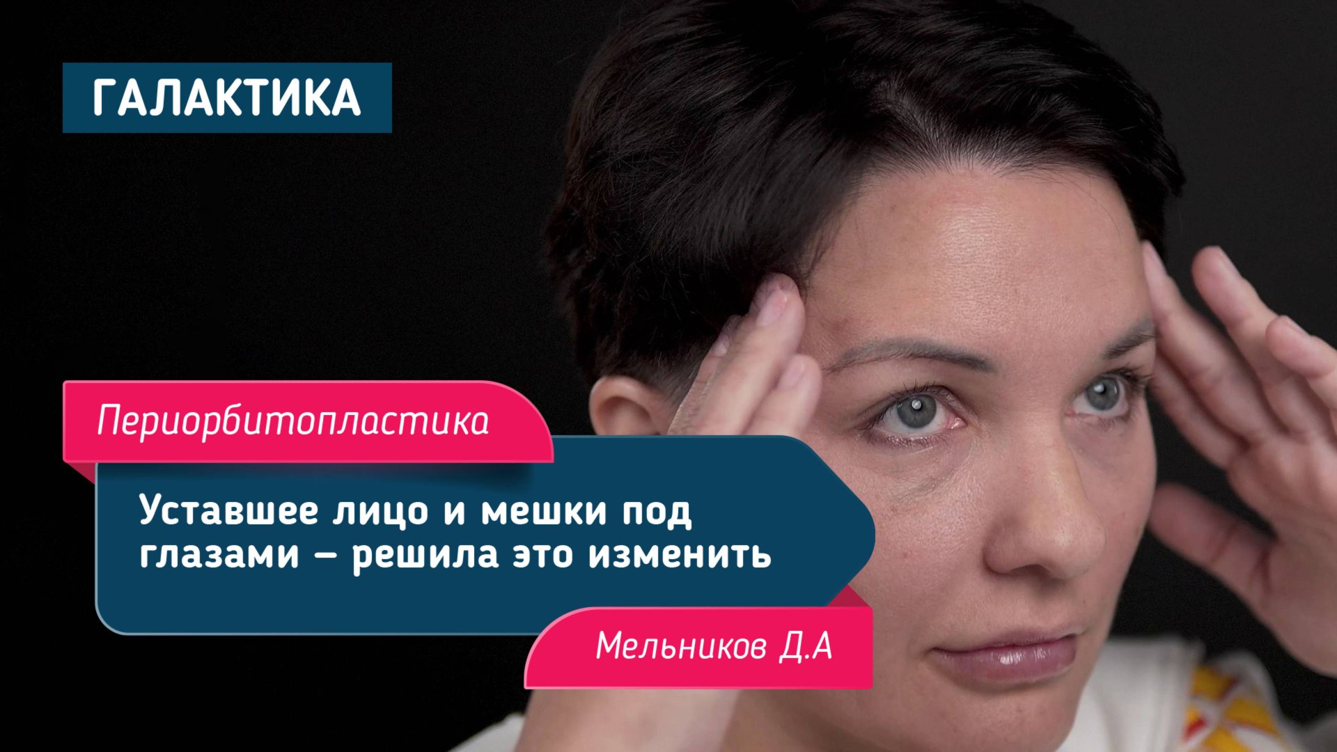 Периорбитопластика у победительницы «Оморфия» | Ольга у хирурга Дмитрия Мельникова