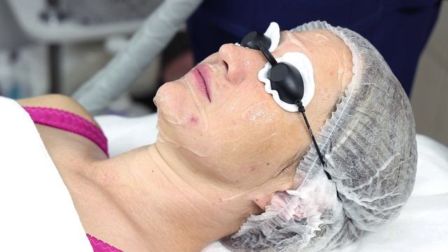 IPL. Эфир. Процедура. Ощущения