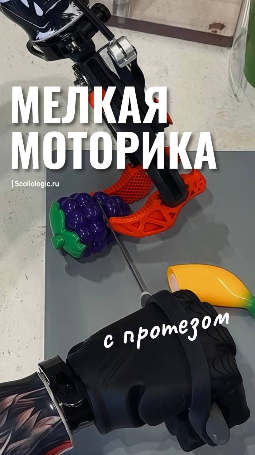 Мелкая моторика в протезе: на что способна современная кисть?