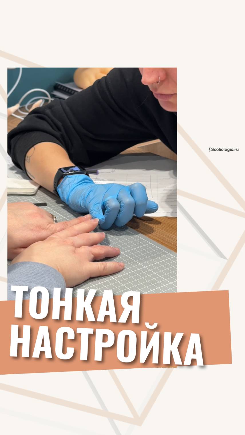 Косметический протез пальцы