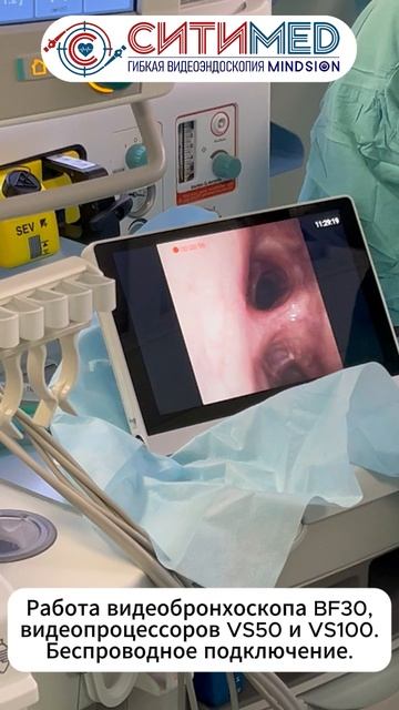Апробация гибкого беспроводного видеобронхоскопа Mindsion BF30 в КНЦ им. А.С. Логинова