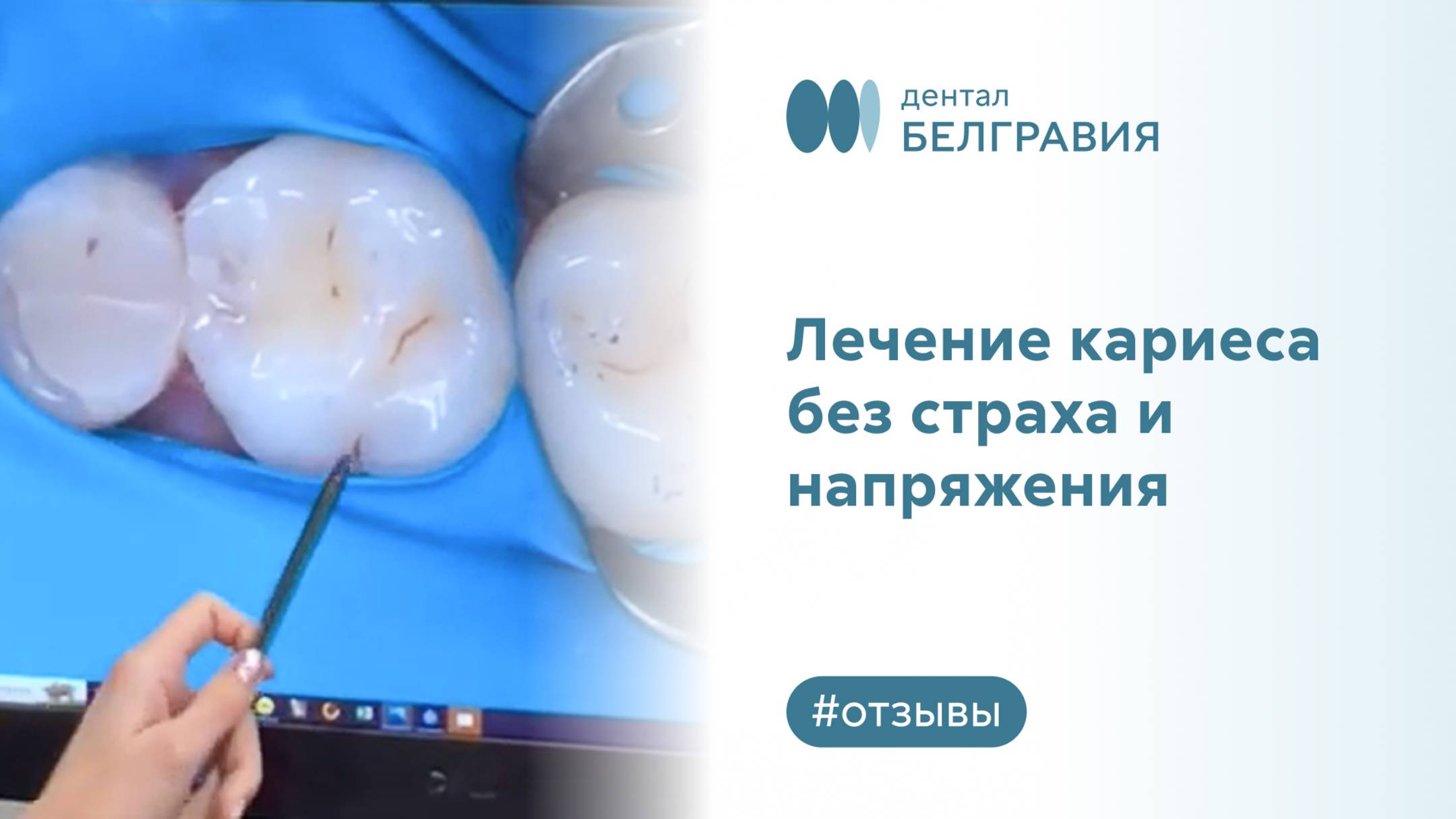 Лечение кариеса без страха и напряжения - отзыв