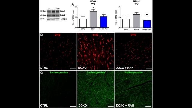 Ранолазин на защите миокарда: рак, доксирубицин, управление окислительным фосфорилированием