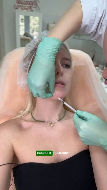 Эффект «замороженного лица» после ботулинотерапии