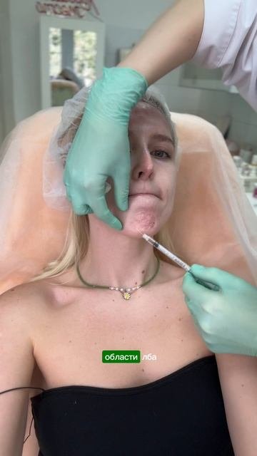 Ботулинотерапия Xeomin