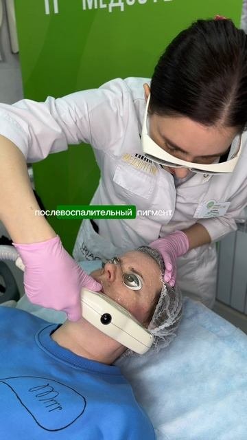 IPL-терапия для борьбы с пигментом