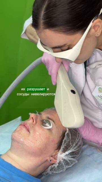 Фотоомоложение: что за процедура?