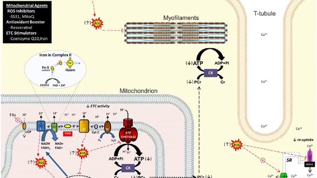 Метаболическая ловушка при СД (окислительное фосфорилирование и жиры) разрушает сердце и Ранолазин