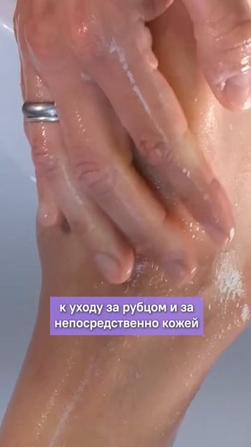 Как правильно ухаживать за культей?Узнали у реабилитолога Динамики Алины Соколовой 🎥