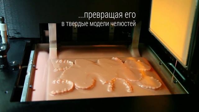 Процесс изготовления Элайнеров VSD