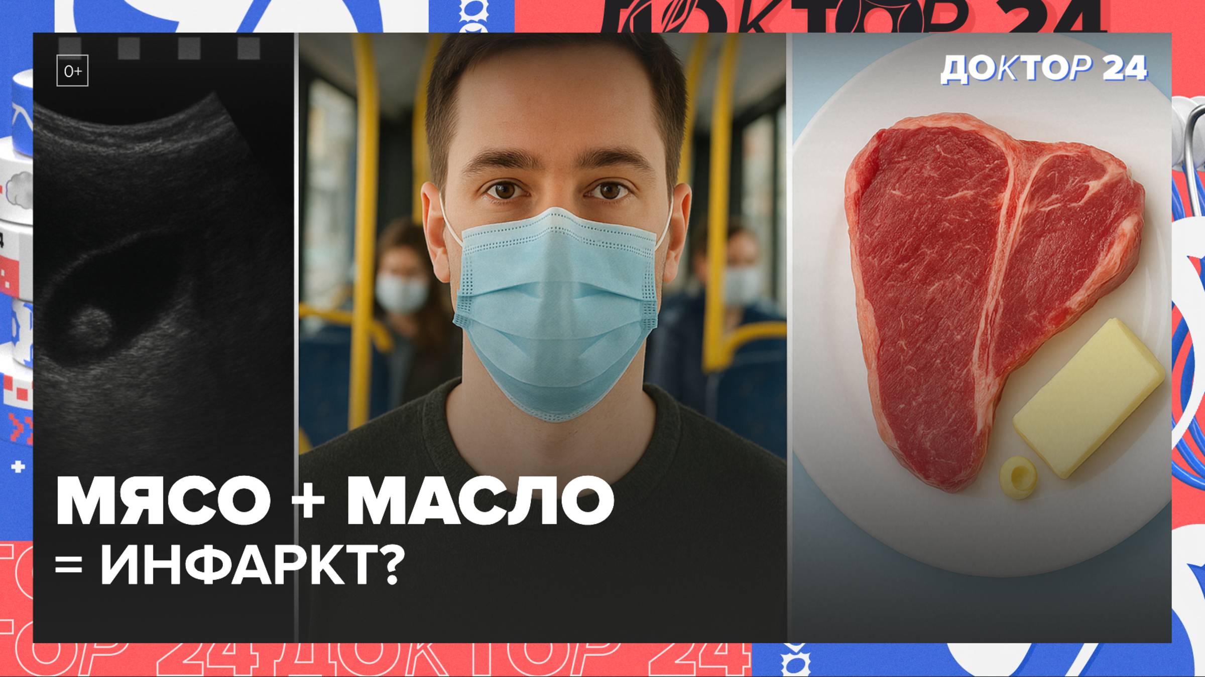 ПОЛИПЫ В ЖЕЛЧНОМ ПУЗЫРЕ, ВИРУСЫ В ТРАНСПОРТЕ, НИТРОГЛИЦЕРИН И ДИЕТА-МЯСОЕД | Доктор 24