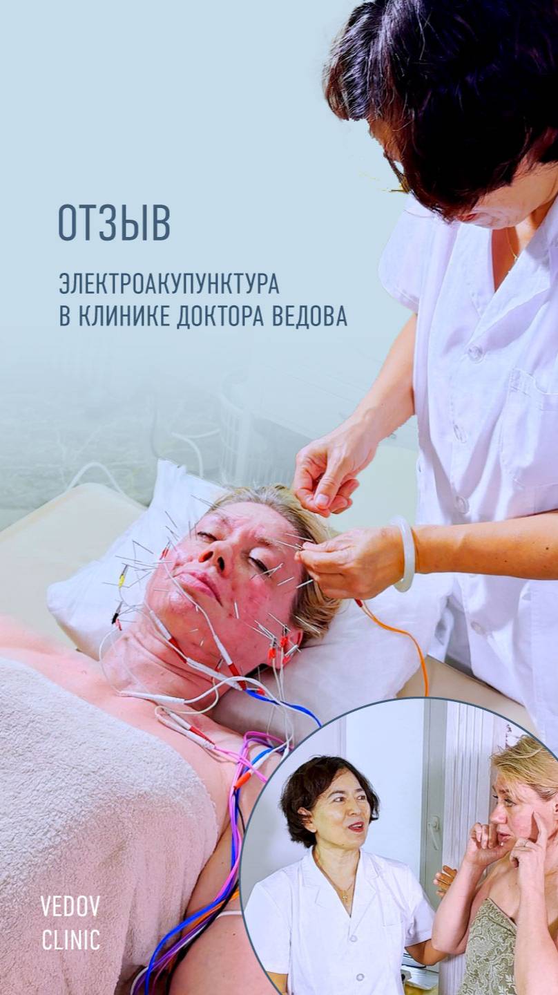 Отзыв об электроакупунктуре в клинике доктора Ведова