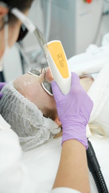 Фотоомоложение Candela Nordlys