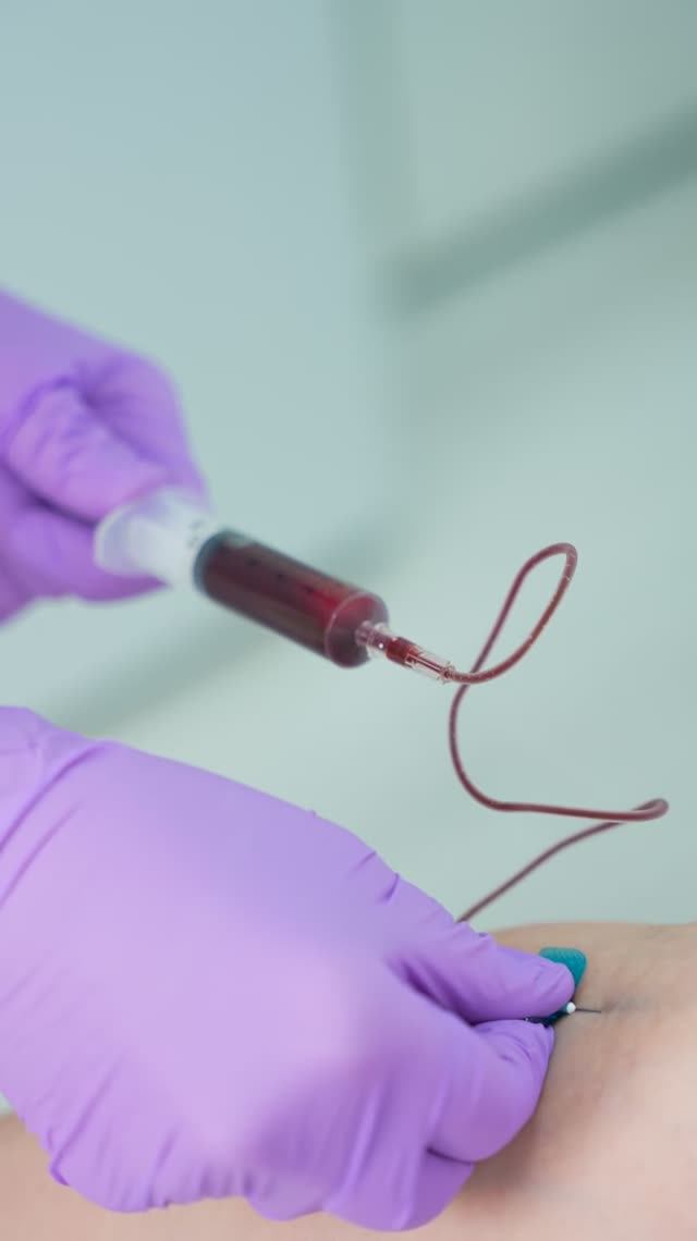 Плазмотерапия Cortexil PRP