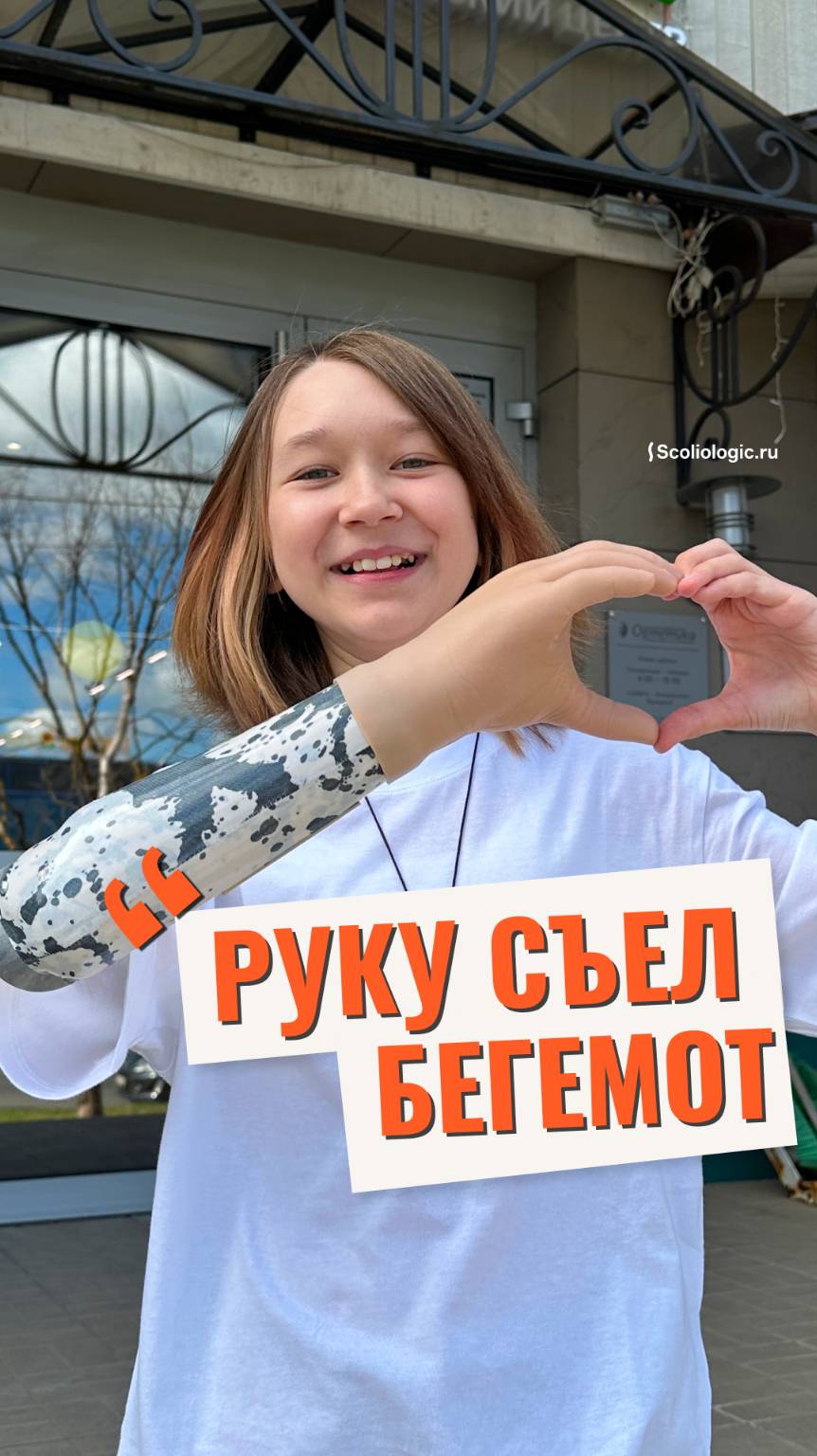 3 новых протеза, 1 бегемот и 0 сомнений в своей крутости