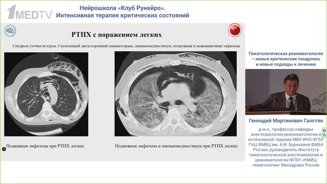 Гематологическая реаниматология Галстян Г.М. 2025