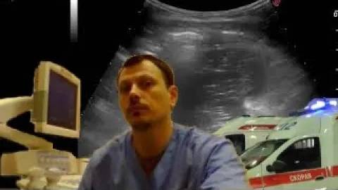 Детское УЗИ брюшной полости - Периаппендикулярный абсцесс