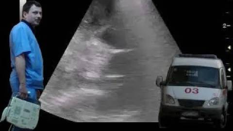 Детское УЗИ брюшной полости - Врожденная диафрагмальная грыжа, субтотальный некроз кишечника