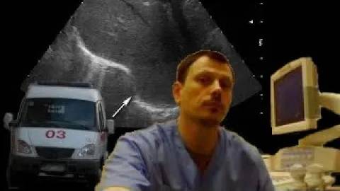 Детское УЗИ брюшной полости - Доля Риделя печени