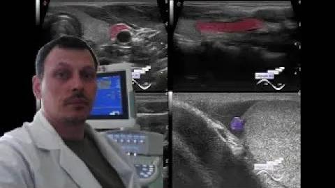 Детское УЗИ щитовидной железы - Близкие друзья