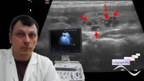 Детское УЗИ щитовидной железы - Диффузно-очаговые изменения щитовидной железы