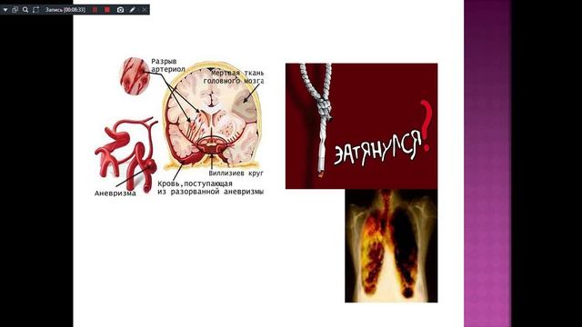тема № 15- 231-6.12.25 курение и его влияние на состояние здоровья