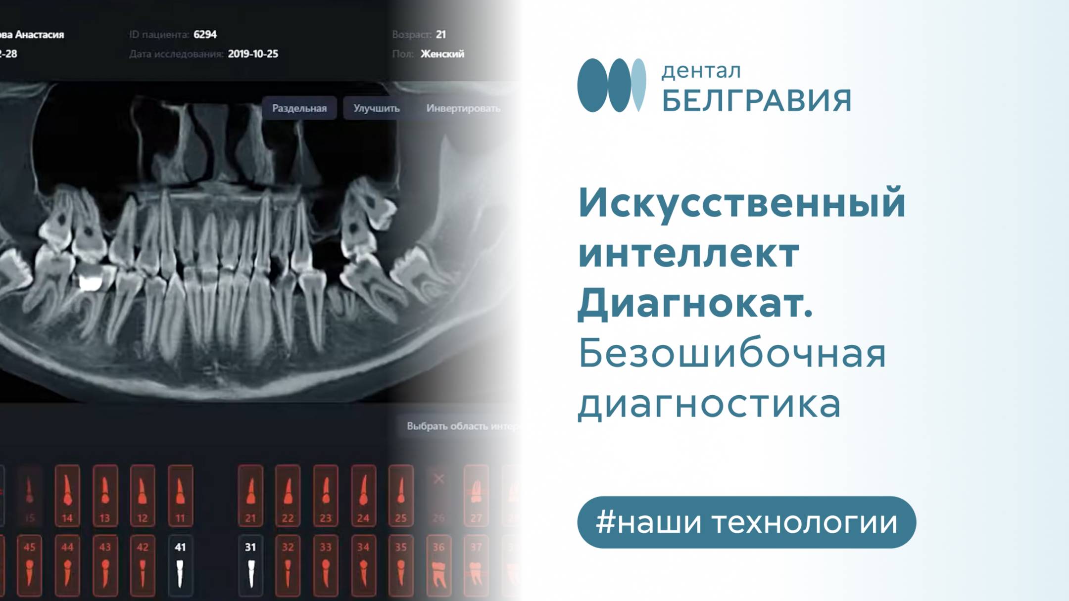 Искусственный интеллект Диагнокат. Безошибочная диагностика