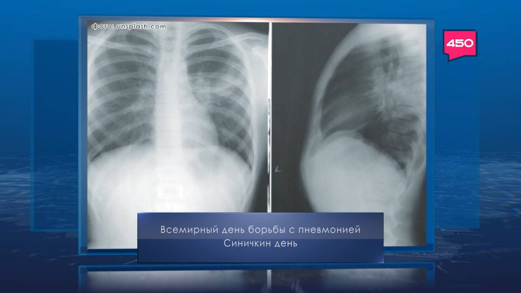 Всемирный день борьбы с пневмонией. Календарь Губернии от 12 ноября