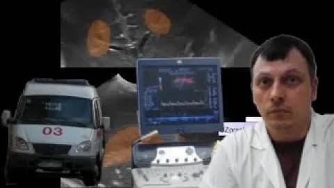 Нейросонография (УЗИ головного мозга) - Перивентрикулярная лейкомаляция