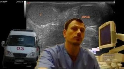 Детское УЗИ мошонки - Фантомное яичко или сперматогенная гранулема