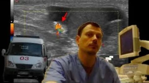 Детское УЗИ мошонки - Жемчужина/ камень мошонки, мерцающий артефакт