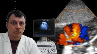 Детское УЗИ сердца (эхокардиография) - Фенестрация МПП / Множественные ДМПП