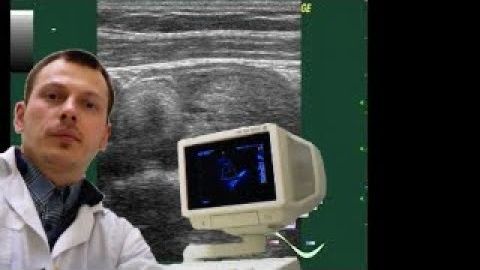 Детское УЗИ органов малого таза - Тератома яичника