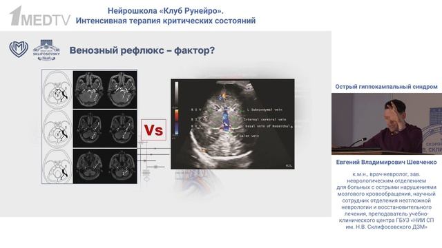 Острый гиппокампальный синдром Шевченко Е.В. 2025