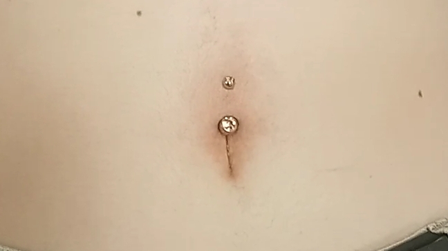 Прокол пупка