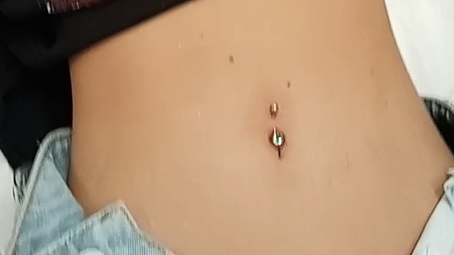 Прокол пупка