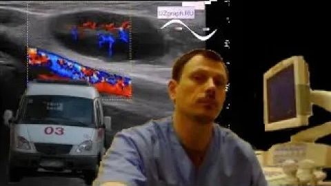 Детское УЗИ мягких тканей - Гнойное расплавление лимфатического узла